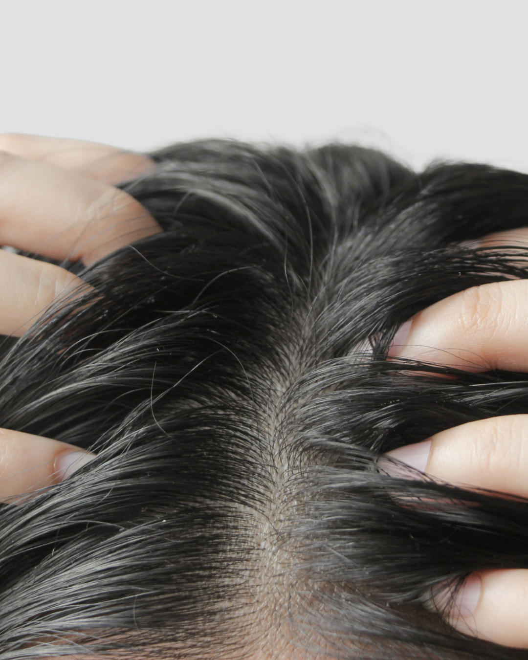 Oily Scalp - AglowHair Malaysia